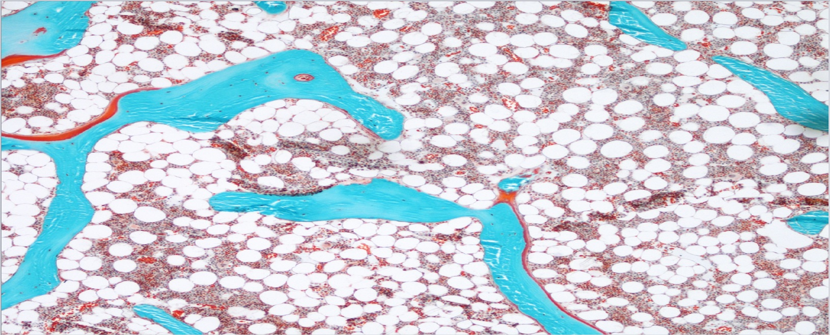 Beenmergvet: goed of slecht voor je botten? | Wetenschap.nu